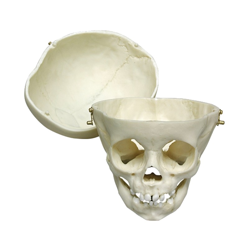 Paediatric Skull Cast (1-Year-Old) - MedicalSupplies.co.uk